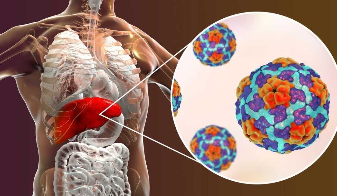 How to Prevent Hepatitis? Check out the Types and Treatments