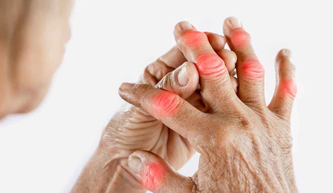 Gejala Arthritis Rheumatoid: Penyebab dan Pengobatannya