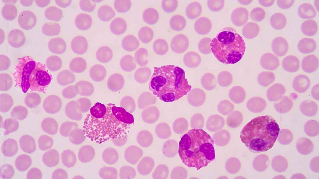 Waspada! Inilah 10 Ciri-ciri HIV Pada Kulit yang Dapat Anda Kenali ...